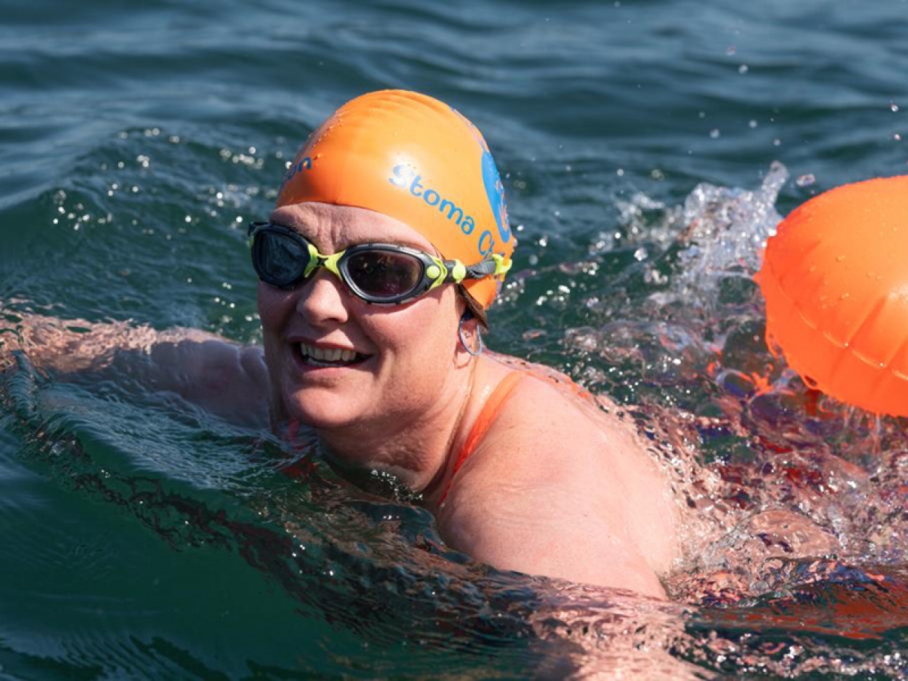 Gill Castle from Alnwick is Swimming the Channel with a Stoma | Living ...